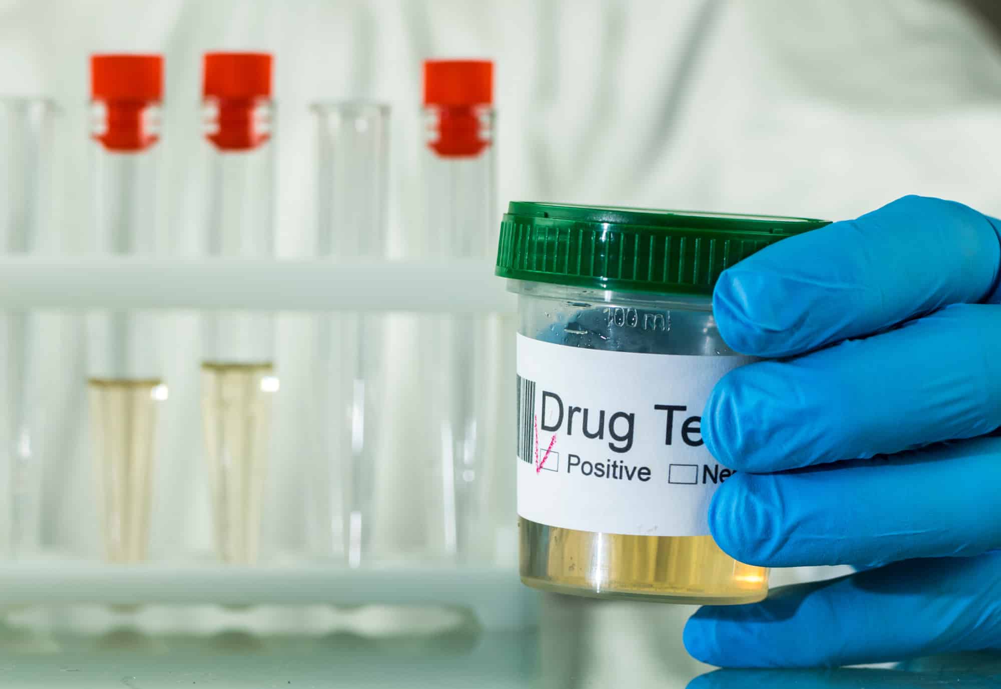 What Happens if You Fail a Drug Test? A Complete Guide