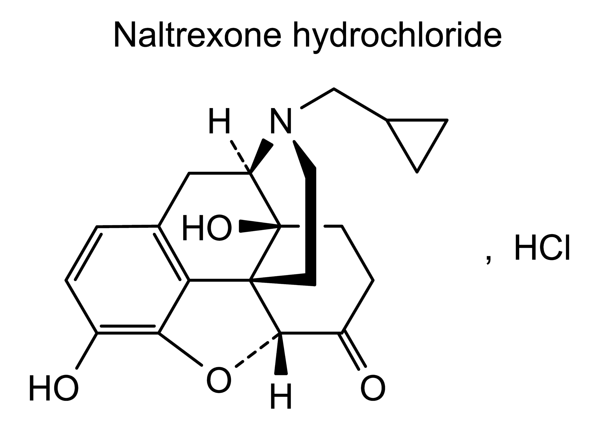 Acamprosate vs. Naltrexone: A Complete Guide